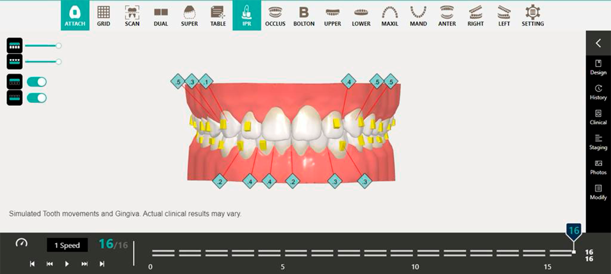 Software Video – ClearX Iberia