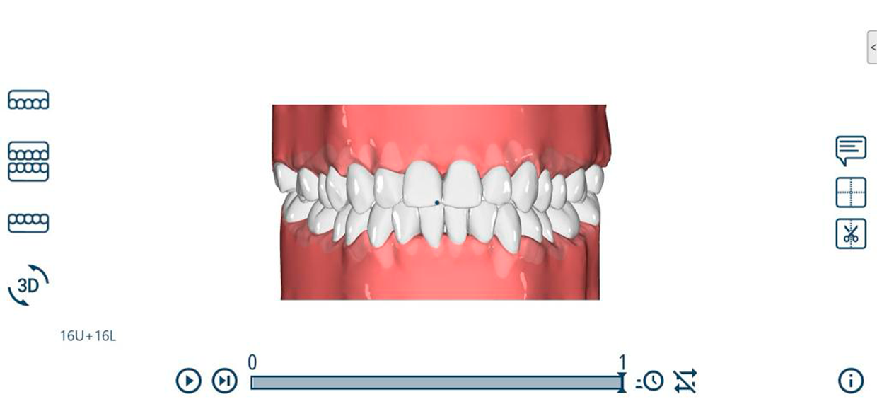 Software Video – ClearX Iberia